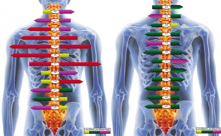 Myovision Scans - Complete Health Chiropractic